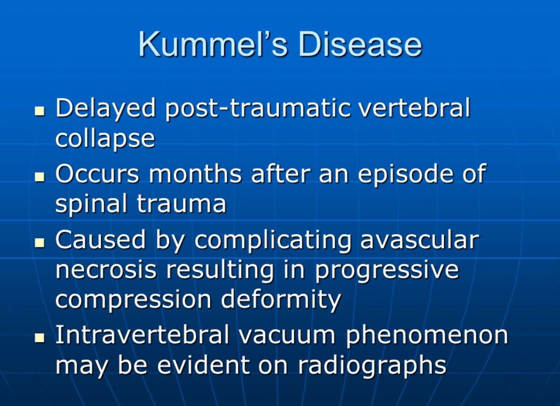 Kummel Disease – Avascular Necrosis-Osteonecrosis Education and Resources
